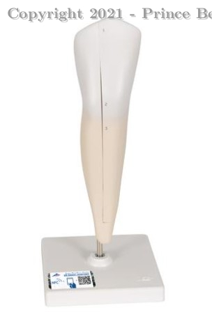 52696958 - lower canine right