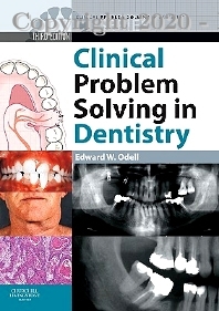 47861711 - Clinical Problem Solving in Dentistry, 3E