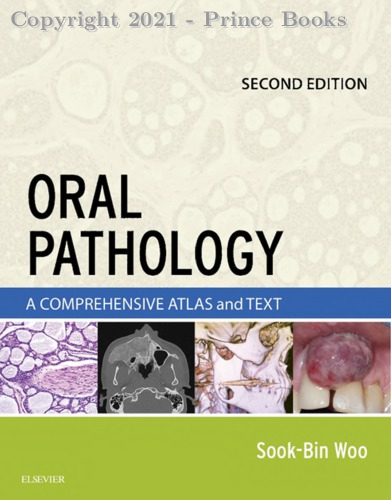 77999948 - Oral Pathology: A Comprehensive Atlas and Text, 2e