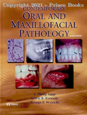 03764427 - contemporary oral and maxillofacial pathology, 2e