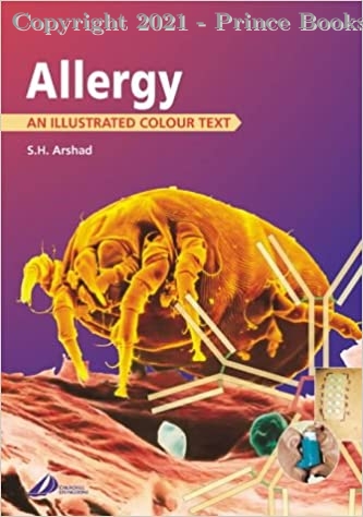 9780443062711 - Allergy An Illustrated Colour Text, 1e