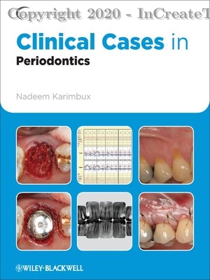 83083091 - Clinical Cases in Periodontics