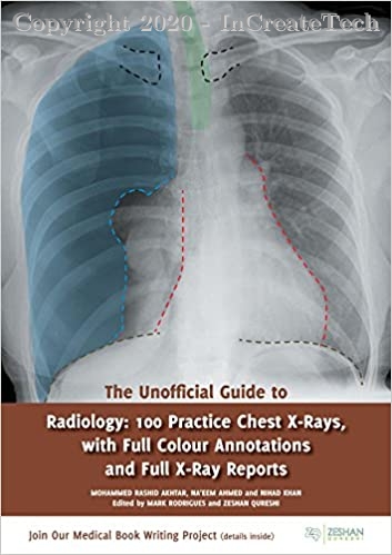 9781910399019 - The Unofficial Guide to Radiology: 100 Practice Chest X ...