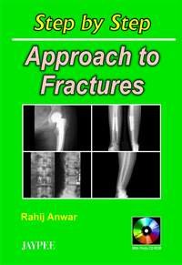 75209963 - STEP BY STEP APPROACH TO FRACTURES, 1E